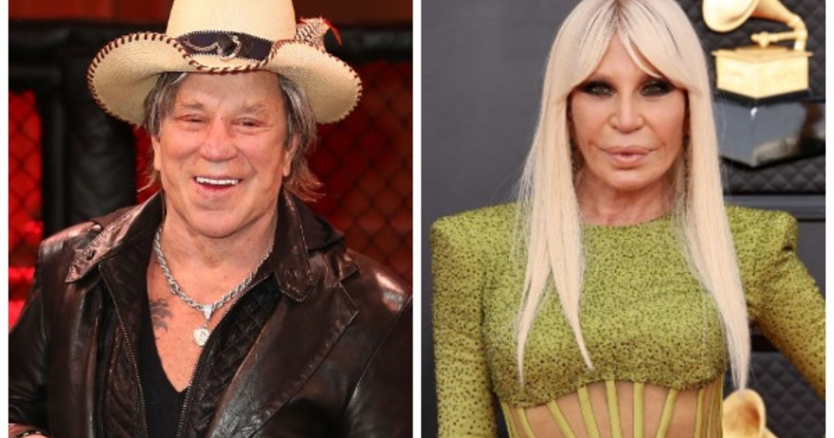 Невдалі пластичні операції зірок фото - IVONA.UA