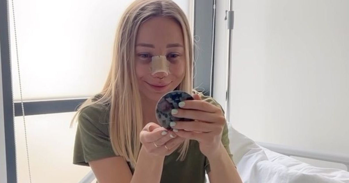 Жена Виктора Павлика показала, как изменилась ее внешность после пластики — фото до и после ...